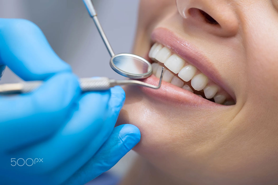 Fillings & Root Canal Treatment - The Lodge Dental